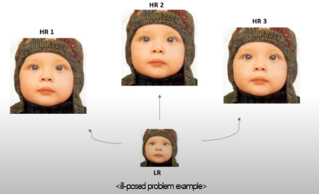 [논문리뷰]An overview of deep learning in medical imaging focusing on MRI
