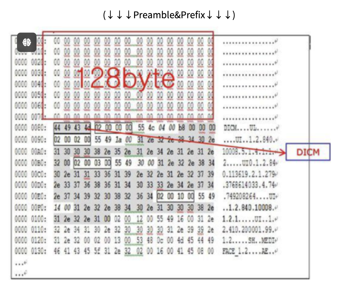 디지털 의료 데이터 (3) - DICOM 의료 정보 처리하기