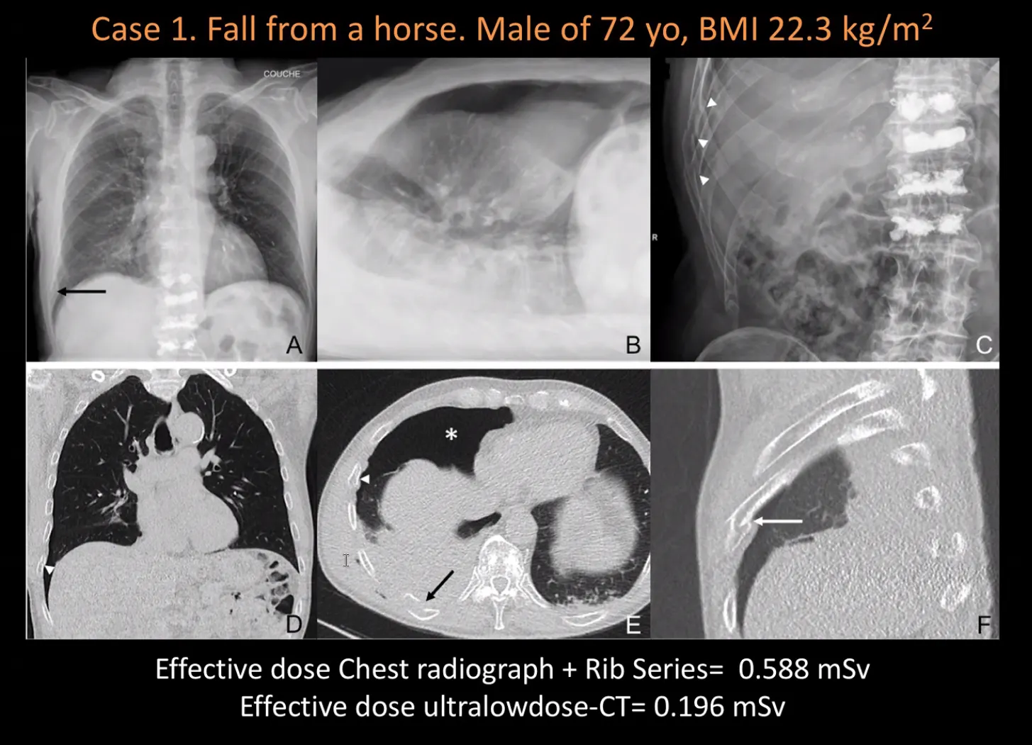 [BDA] JOB 강연: 의료 데이터(1)