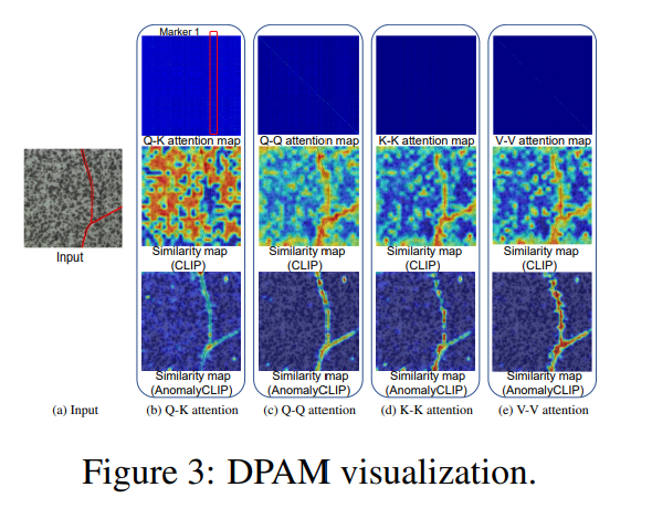 ANOMALYCLIP: OBJECT-AGNOSTIC PROMPT LEARNING FOR ZERO-SHOT ANOMALY DETECTION