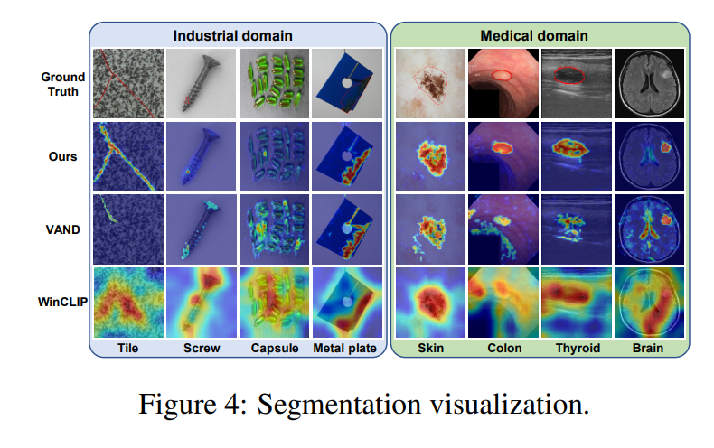 ANOMALYCLIP: OBJECT-AGNOSTIC PROMPT LEARNING FOR ZERO-SHOT ANOMALY DETECTION
