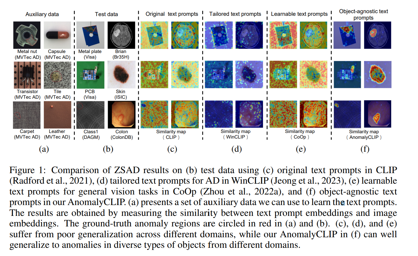 ANOMALYCLIP: OBJECT-AGNOSTIC PROMPT LEARNING FOR ZERO-SHOT ANOMALY DETECTION