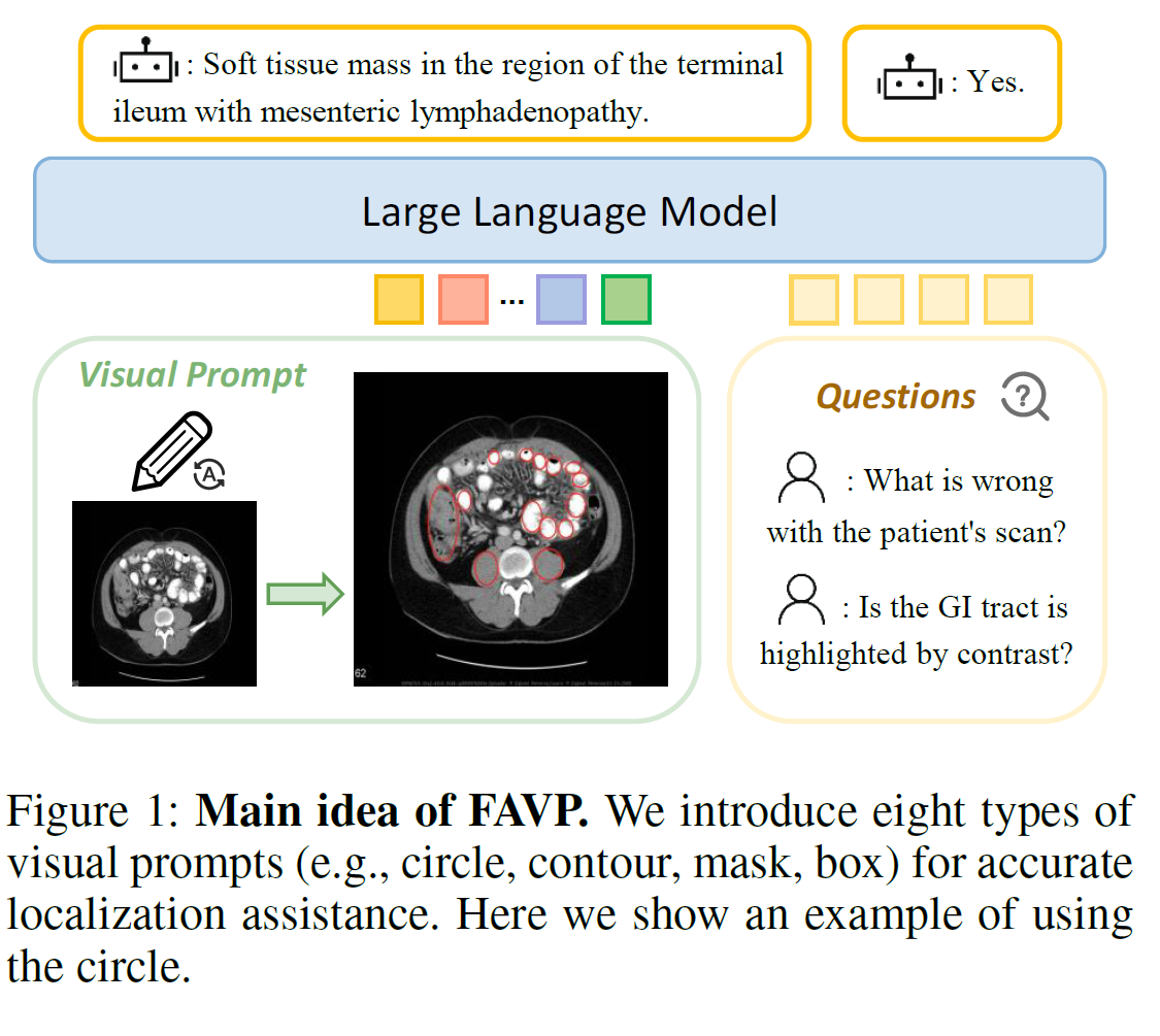 [논문리뷰] Fine-grained Adaptive Visual Prompt for Generative Medical ...