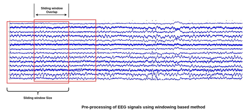 Neurogan Image Reconstruction From Eeg Signals Via An Attention Based Gan