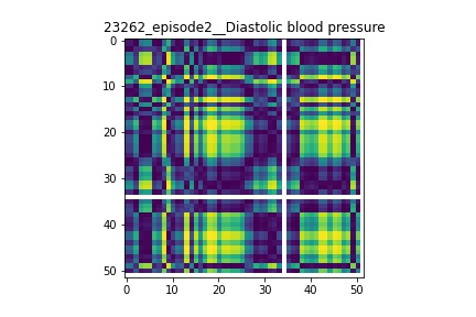 인턴일지 🥕 Tiled CNN 이 뭐야?