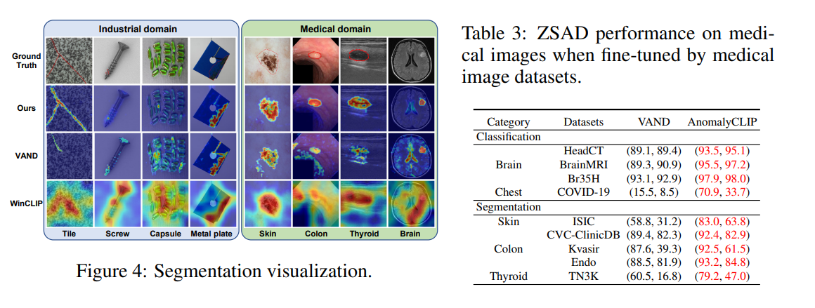 리뷰: ANOMALYCLIP: OBJECT-AGNOSTIC PROMPT LEARNING FOR ZERO-SHOT ANOMALY ...
