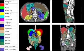 2. Total Segmentator