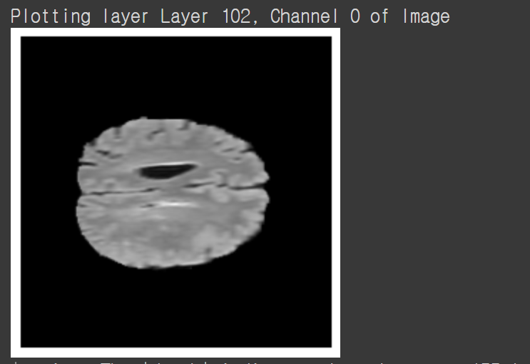 Practice 01. Neuroimaging: Visualize 3D MRI Brain Scans with Python