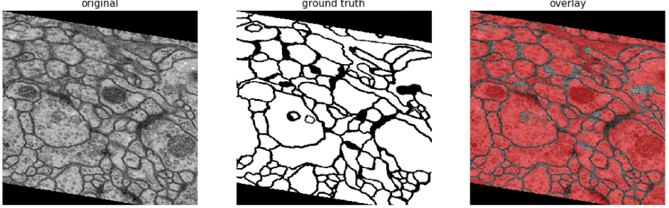 [딥러닝] Semantic segmentation(U-Net)