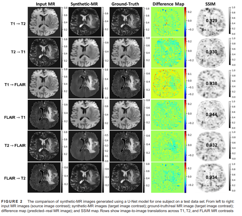 Deep learning-based convolutional neural network for intramodality brain MRI synthesis