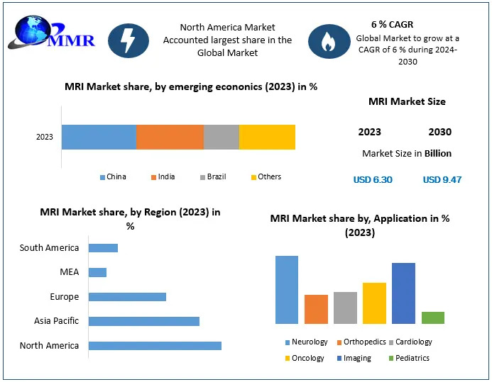 MRI Market Size & Growth Trends: Industry Outlook and Forecast (2024-2030)