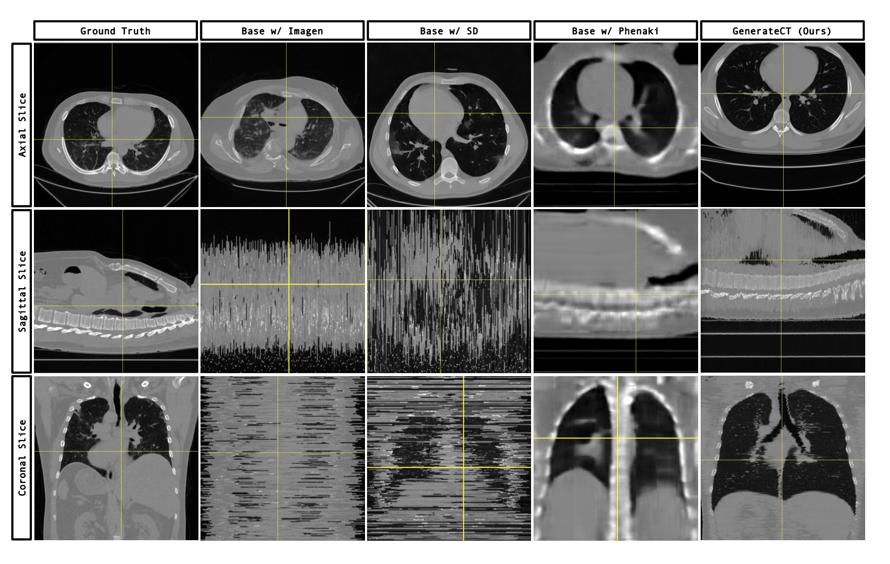 GenerateCT: Text-Conditional Generation of 3D Chest CT Volumes (ECCV 2024)