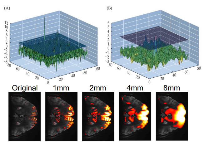 의료영상처리 기말고사