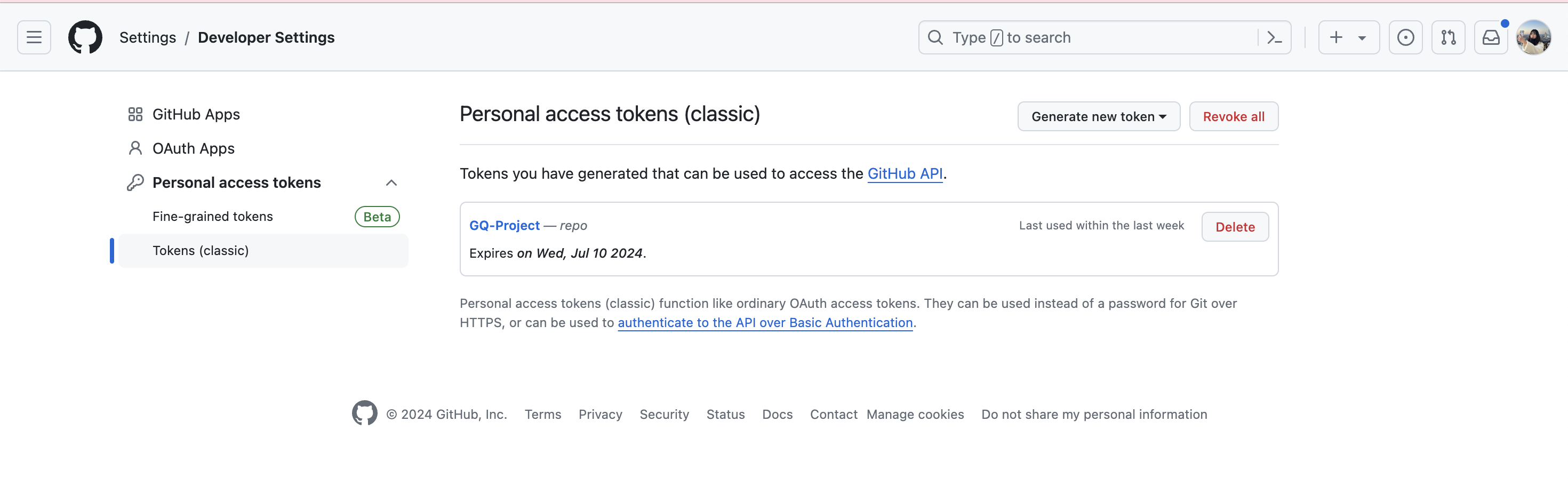 [React] vercel로 배포하기 심화: Github Actions (organization 레포 포크 후 자동 배포)