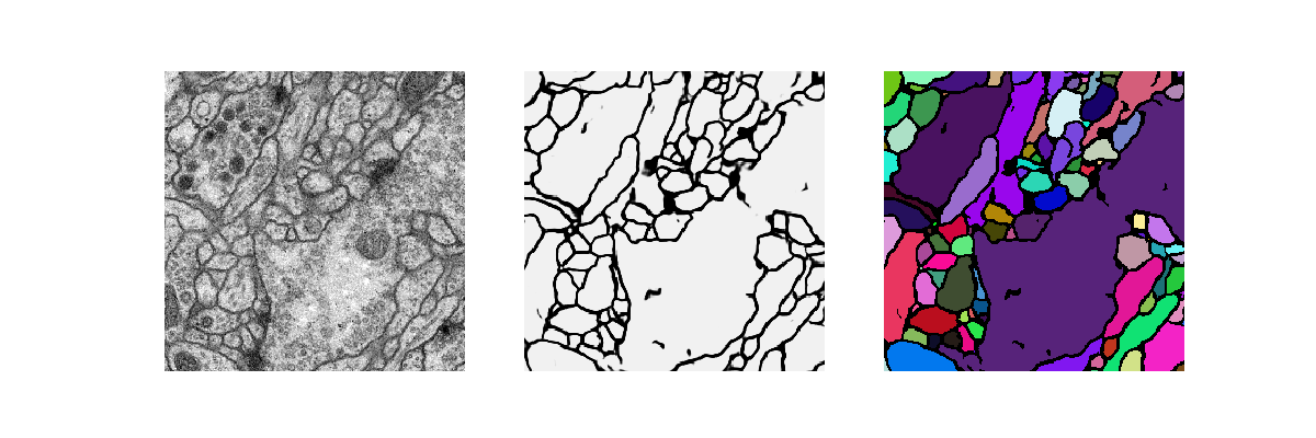 [논문리뷰] U-Net: Convolutional Networks for Biomedical Image Segmentation